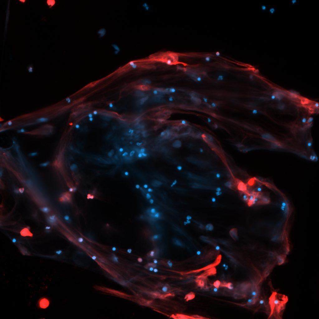 INSERM Unité 1034 - Bordeaux - Biology of Cardiovascular Diseases